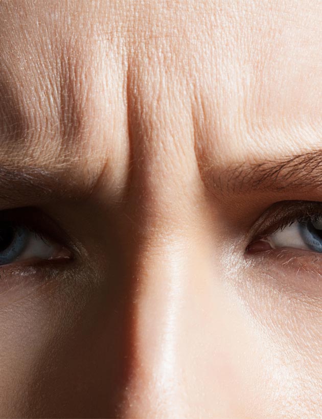 Frown Line Fillers London | SAS Aesthetics