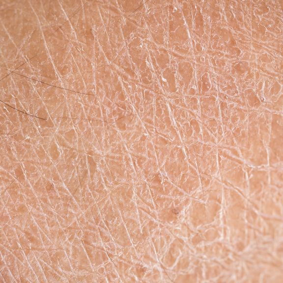 Rejuvenating Your Dull Skin: A Post-Summer Guide to Repairing Sun ...